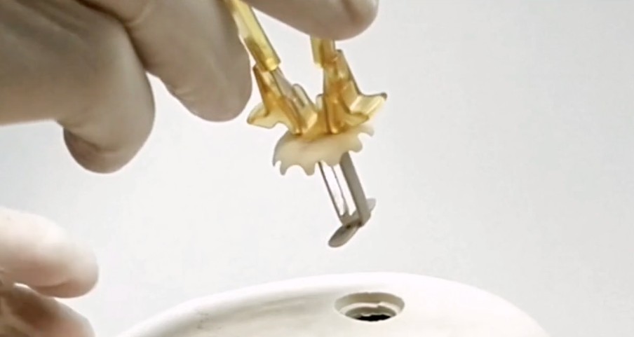 NEOS Surgery - Cranial COVER implantation procedure